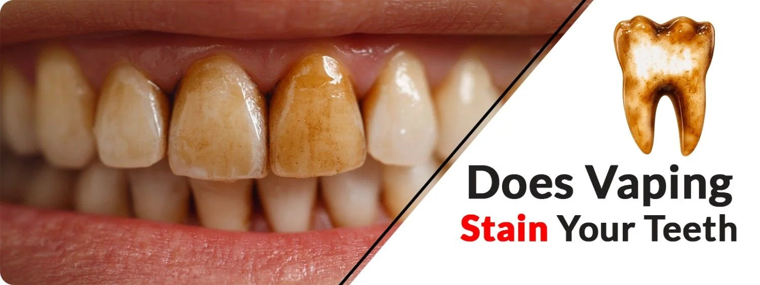 Does Vaping Stain Your Teeth? Effects, Risks & Prevention
